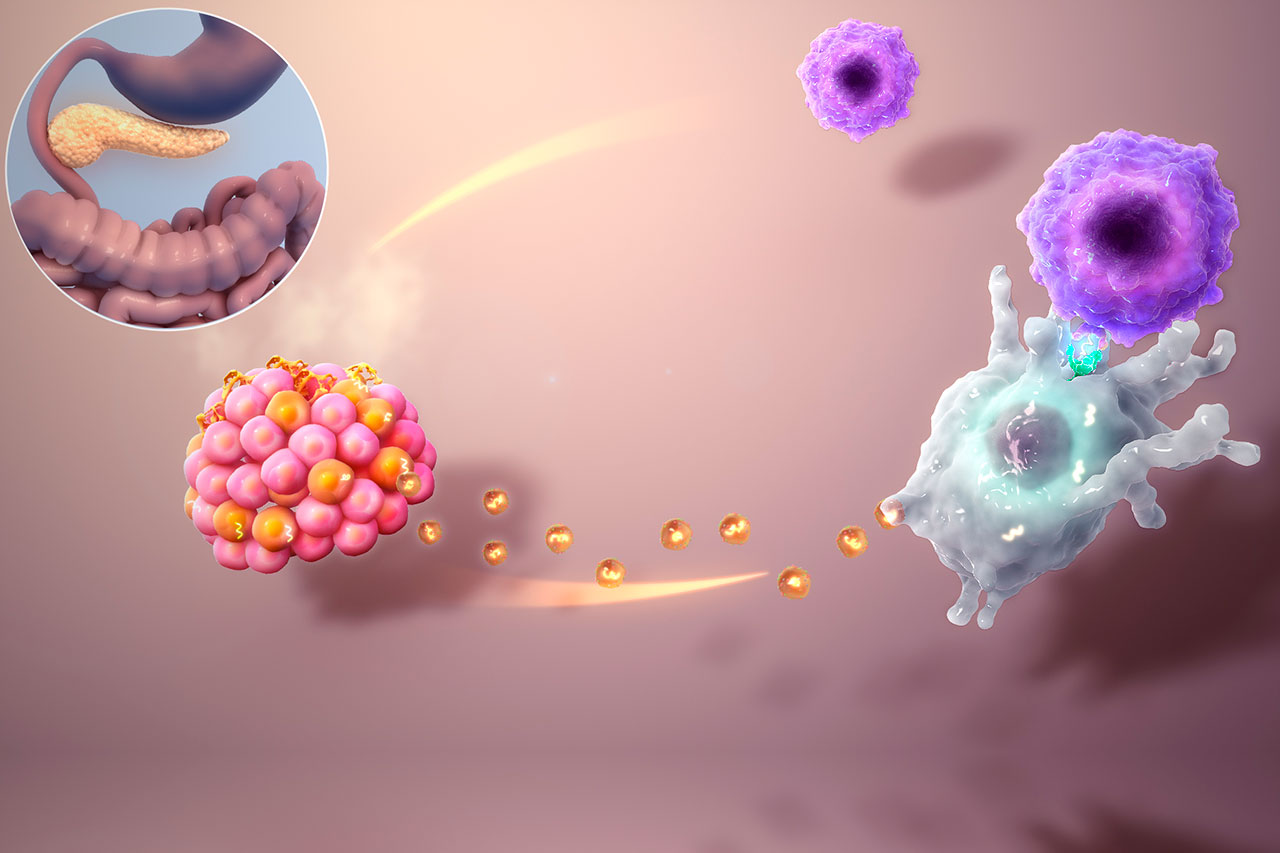 ¿Qué es la Diabetes Mellitus? - BioQuimia Laboratorio